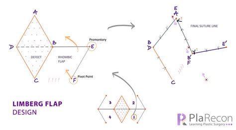 Limberg Rhombic Flap