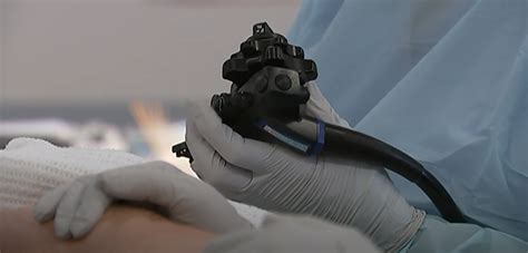 Half Of Repeat Colonoscopies Dont Meet Guideline Intervals