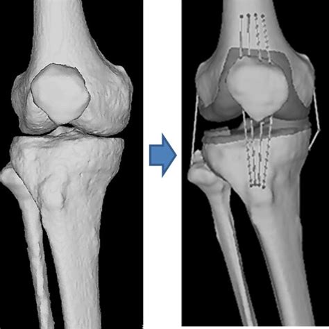 This Image Is A 3d Image Obtained By Multi Slice Ct With Ligament