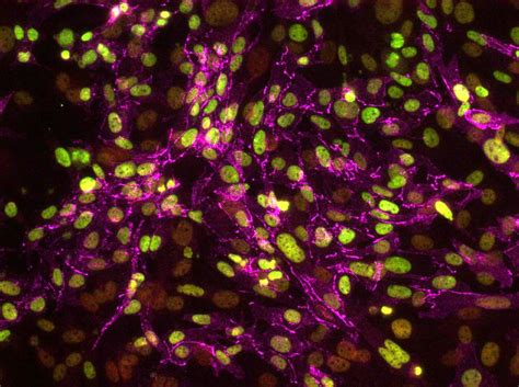 Scientists At Ucla Develop Method To Define Stages Of Stem Cell Reprogramming Ucla
