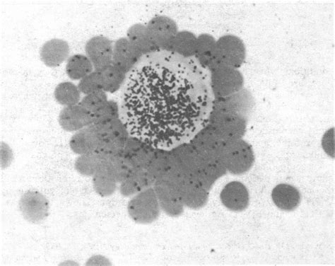 Autoradiograph Of Pha Stimulated H Rosette Forming Lymphocyte