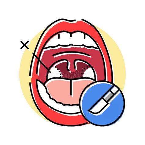 Tonsillectomy Surgery Color Icon Vector Illustration Stock Illustration