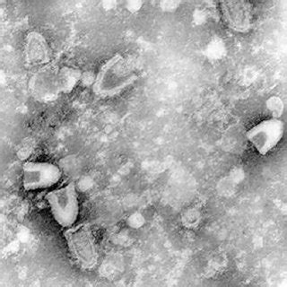 Pdf Infectious Hematopoietic Necrosis Virus Advances In Diagnosis
