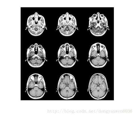 Matlab Montage Csdn博客