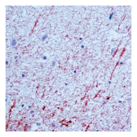 Thermo Scientific Lab Vision Myelin Basic Protein Ab 1 Rabbit