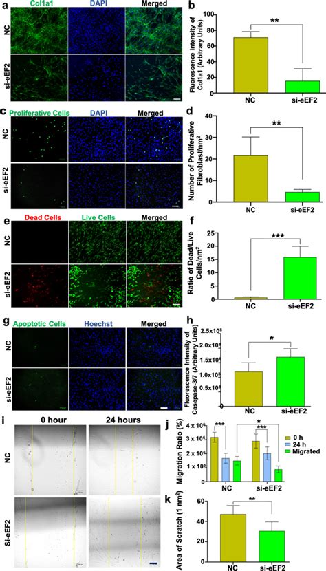 Eef2 Improves Dense Connective Tissue Repair And Healing Outcome By Regulating Cellular Death