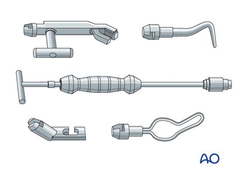 Femoral Stem Removal