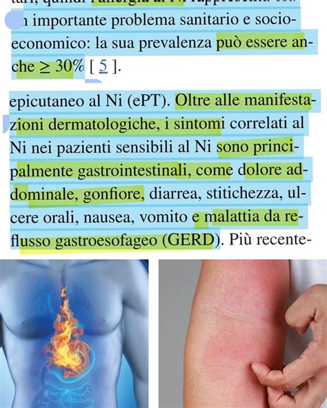 Elisa Bertozzi Fisioterapista Osteopata Fidenza