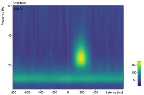 Besa® Brain Electrical Source Analysis Besa Connectivity Features In Besa Connectivity 20