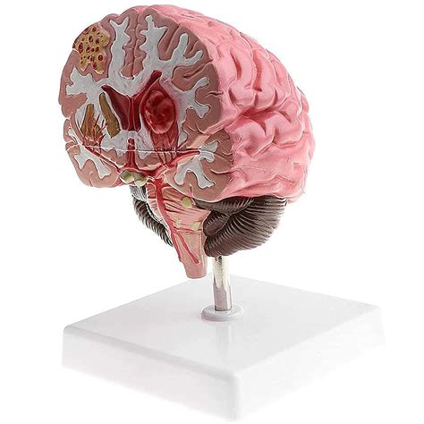 Pathological Brain Structure Anatomy Model Life Size Human Brain Model