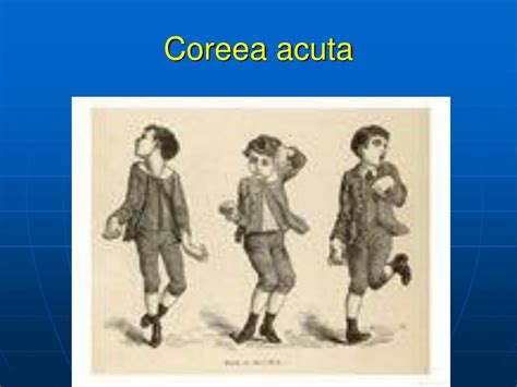 Ppt Coreea AcutĂ Sydenham Powerpoint Presentation Free Download Id 4094684