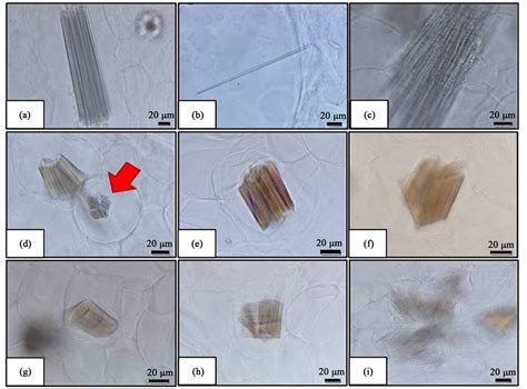 Calcium Oxalate Crystals In Plants Prismatic Crystals Of Calcium