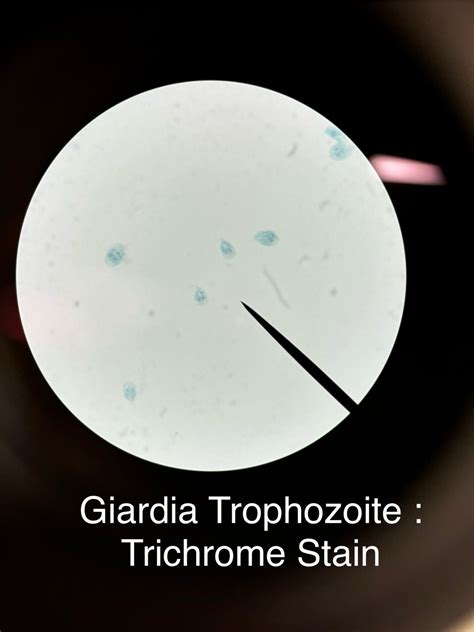 Two Forms Of Giardia Cyst And Trophozoite Sui Hei Yeung