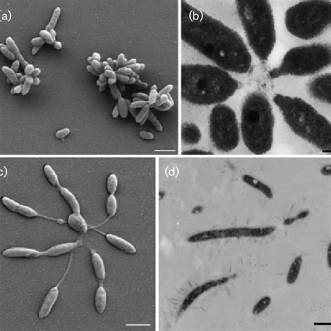Pdf Prosthecate Sphingomonads Proposal Of Sphingomonas Canadensis Sp