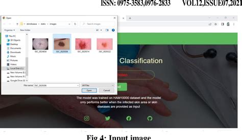 Figure 4 From Deep Learning Algorithms Based Skin Disease Detection And Classification