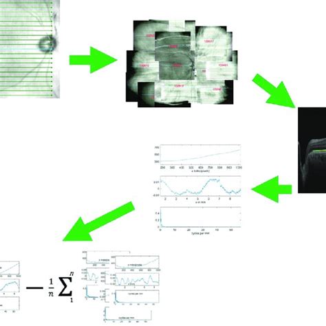 Retinal Oct Shape Irregularity In Different Regions Of The Eye
