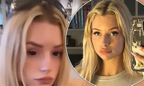 Onlyfans Star Lottie Moss Reveals That She Had Her Fillers Removed In A