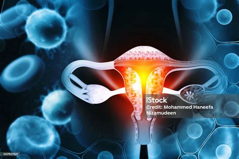 Penyakit Sistem Reproduksi Wanita Kanker Rahim Dan Tumor Ganas