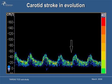 Ppt Tardis Tcd Sub Study Powerpoint Presentation Free Download Id