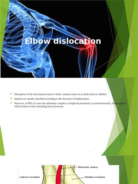 Elbow Dislocation Pdf