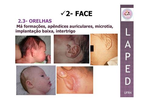 Exame Fisico Em Pediatria Retoedu