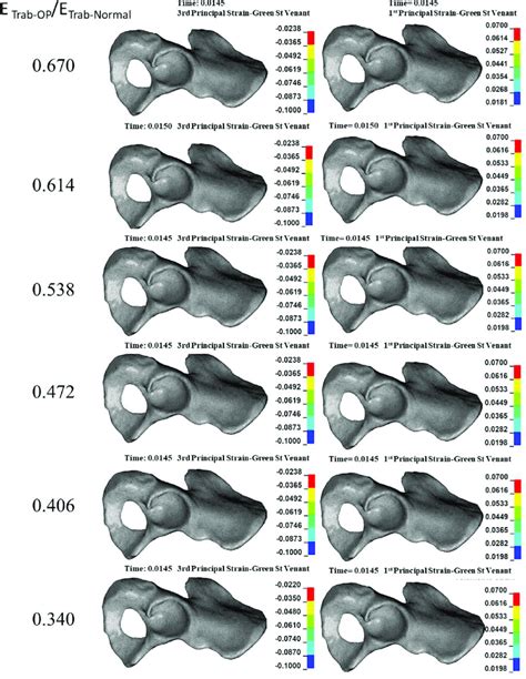 Effect Of Reduction In Trabecular Elastic Modulus E Trab On The Download Scientific Diagram