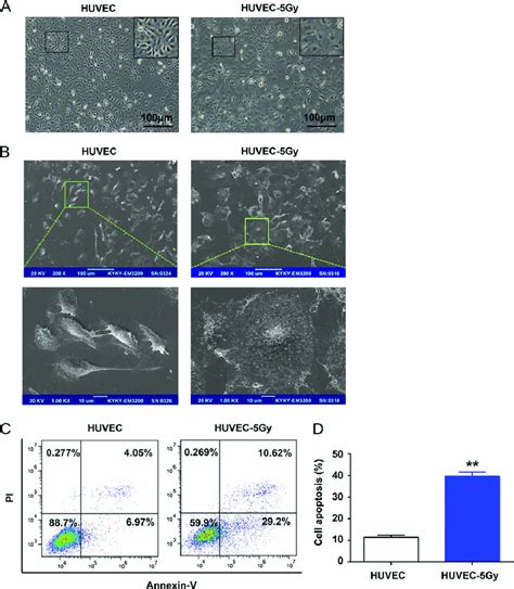 Radiation Induced The Morphologic Alteration And Apoptosis In Huvecs