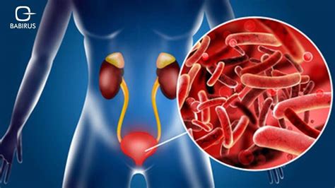 Urinary Tract Infection Diagnosis And Treatment