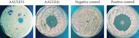 Agar Well Diffusion Test For Antifungal Activity Of Crude Extracts Of