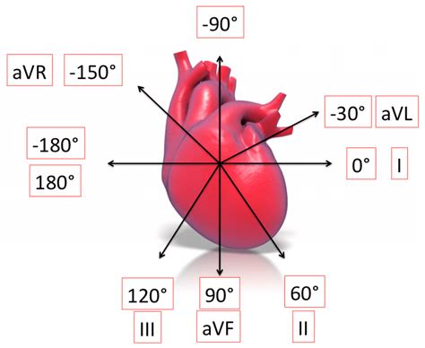 Ecg Axis Deviation Chart Ekg Anatomy Axis From Life In The Fast Lane Medtx Right Axis