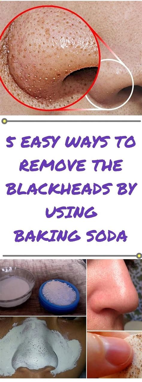 How To Clean Mop Head With Baking Soda At Arnetta Parker Blog