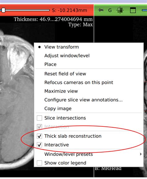New Feature Thick Slab Reconstruction From Slice Controllers And Views Support 3d Slicer
