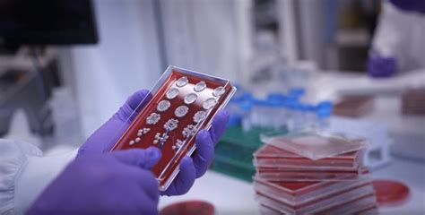 Prof Scott Glickman On Linkedin ‘its Insidious And Its Getting Worse Amr And The Urgent