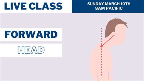 Forward Head Posture Class 3 10