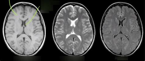 Mri Weights Diagram Quizlet
