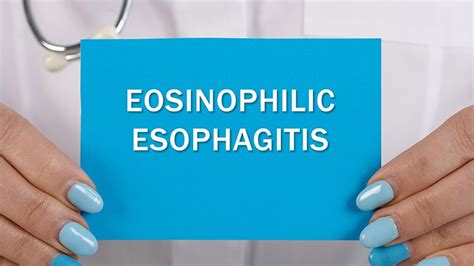 Antibody Response To Food Allergens In Eoe Goes Beyond Igg4