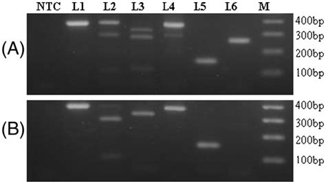 Gel View For Molecular Method For Sex Identification Of Gyps