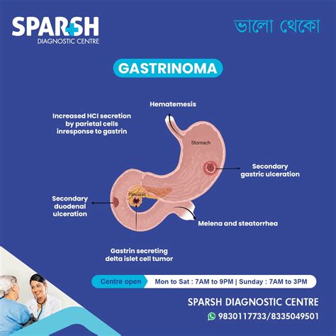 Gastrinoma Sparsh Diagnostic Center