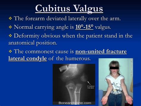Orthopedics 5th Year 3rd Lecture Dr Ariwan