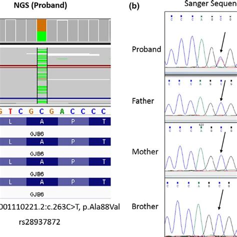 A Targeted Next Generation Sequencing Ngs Identified The Mutation Download Scientific