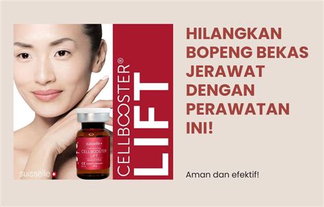 8 Cara Menghilangkan Bopeng Pada Wajah Secara Alami And Cepat St Indonesia