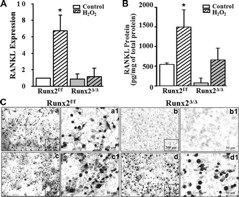 smooth muscle cell specific runx2 deficiency inhibits vascular