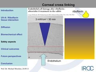 Cross Linking Of Cornea A Review Ppt