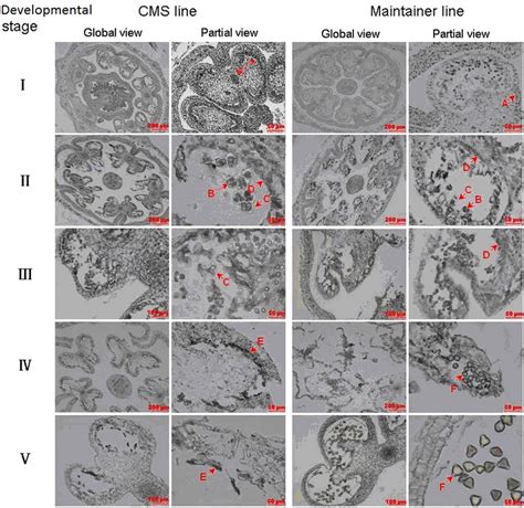 Microspore Development Of The Pepper Anther Cms Line And The Maintainer