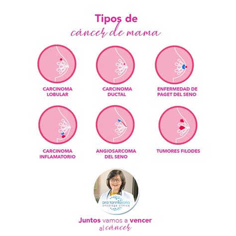 Mamografia De Carcinoma Ductal Invasivo