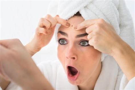 How To Get Rid Of Pimples On Forehead QueenMind