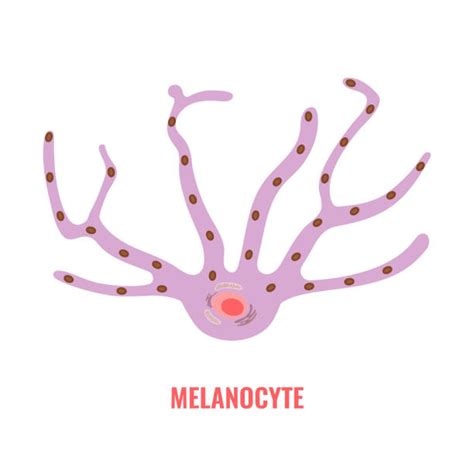 100 Hyperpigmentation Diagram Stock Illustrations Royalty Free Vector