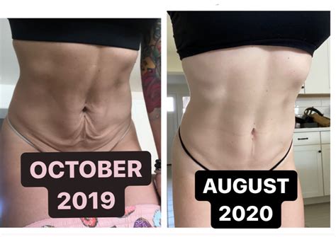How To Tighten Stomach Skin Without Surgery Top 5 Tips Artofit