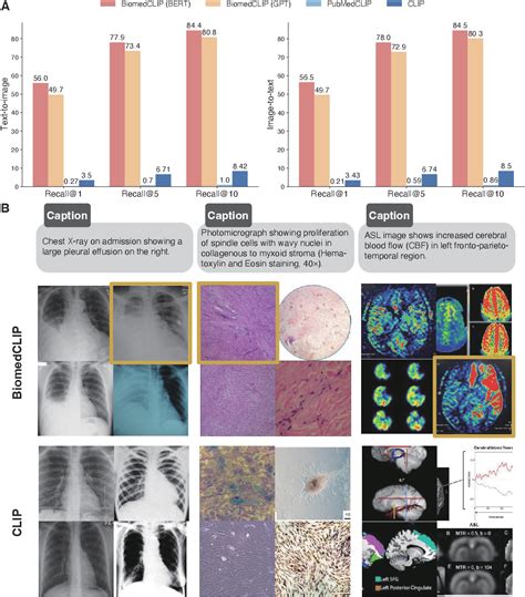 Figure 2 From Biomedclip A Multimodal Biomedical Foundation Model