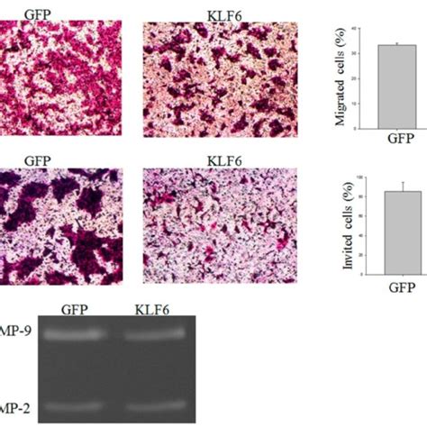 Klf6 Reversed The Expression Of Mesenchymal Markers Cell Lysates From